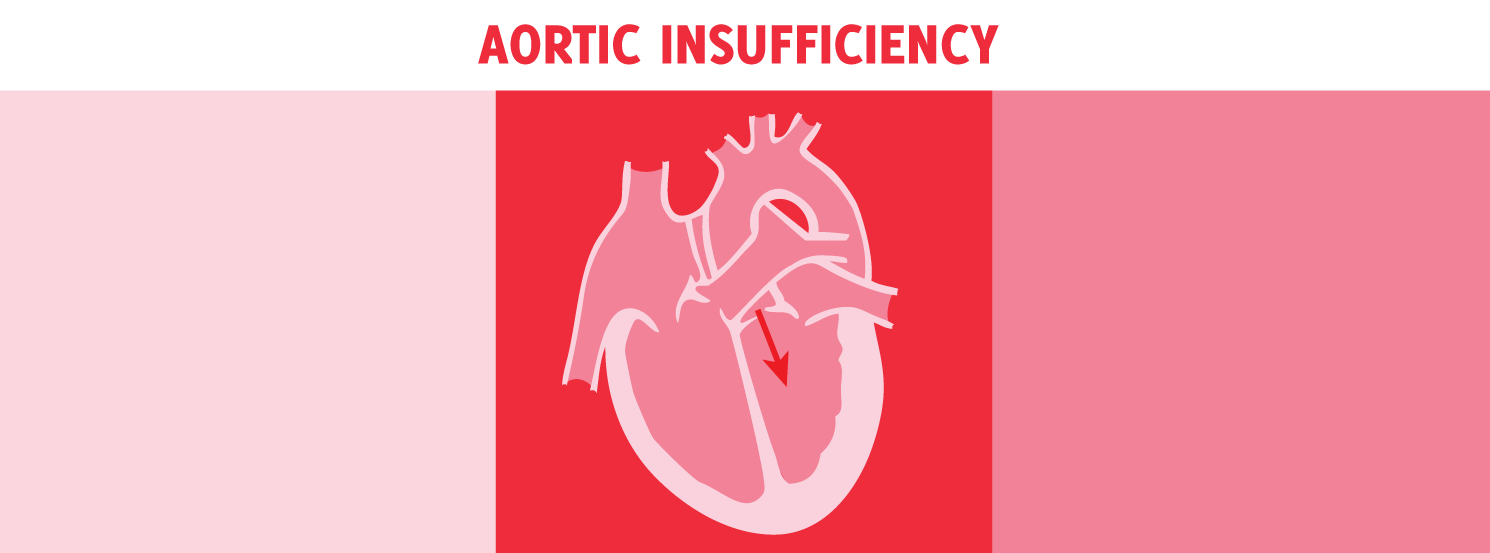 Aortic Insufficiency | HorseDVM Diseases A-Z